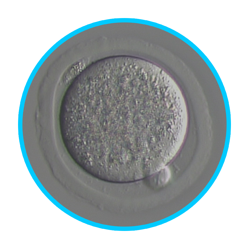 Embryotech – IVF Store